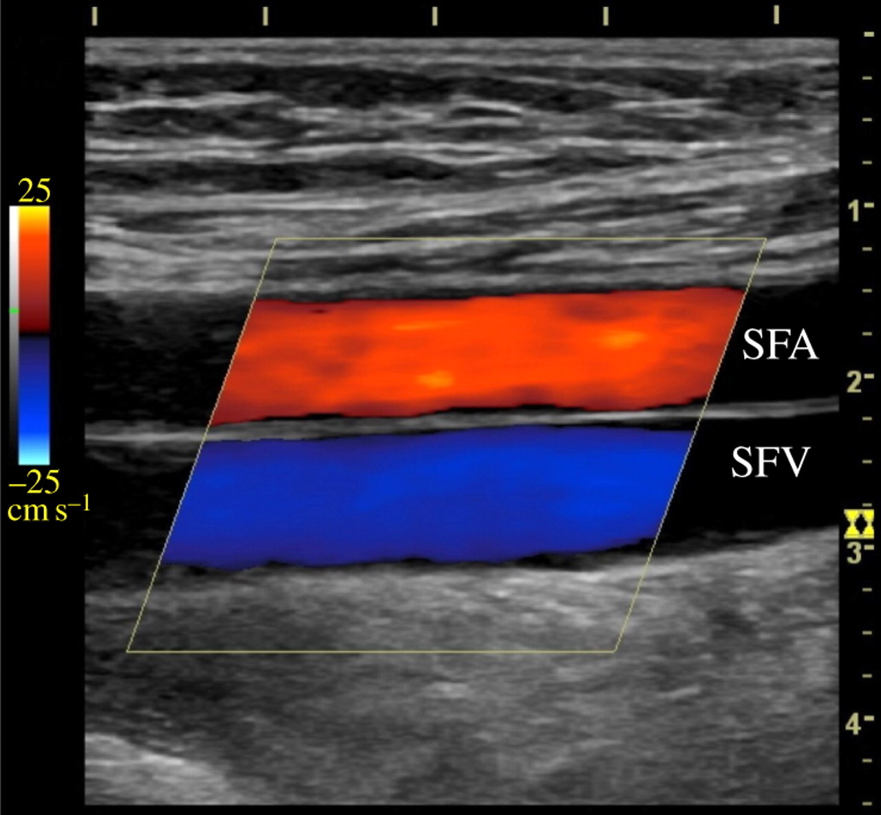 Eco Color Doppler Enna - Studio Radiologico Alerci